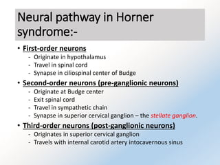 Horner syndrome. Horner's syndrome | PPTX