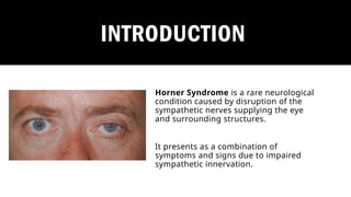 Horner syndrome copy copy.pptx…………………….. | PPTX