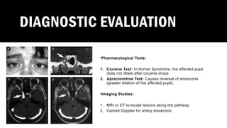 Horner syndrome copy copy.pptx…………………….. | PPTX