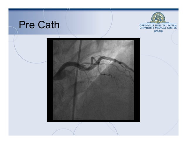 Hospital EMS Case Review STEMI Meeting | PPT | Free Download