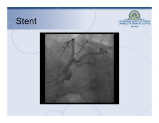 Hospital EMS Case Review STEMI Meeting | PPT | Free Download