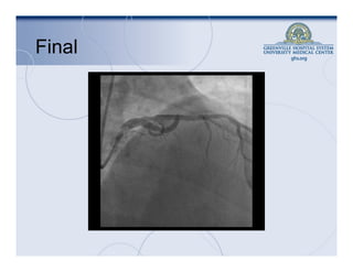 Hospital EMS Case Review STEMI Meeting | PPT