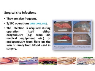 Hospital Acquired Infections Lecture Slide.pdf