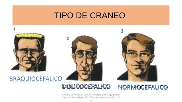 Hospital de especialidades pediátricas perfil facial