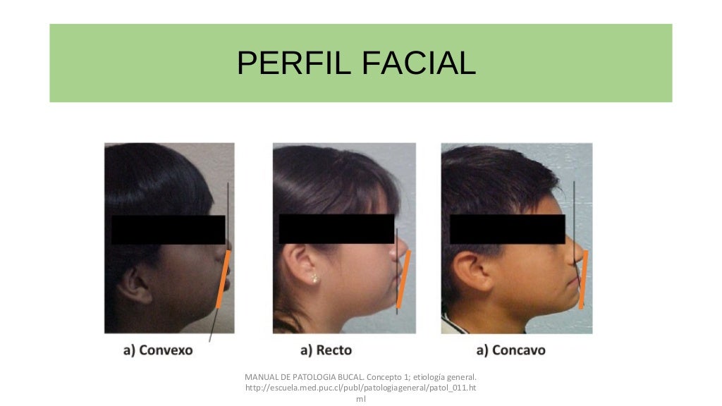 Hospital de especialidades pediátricas perfil facial