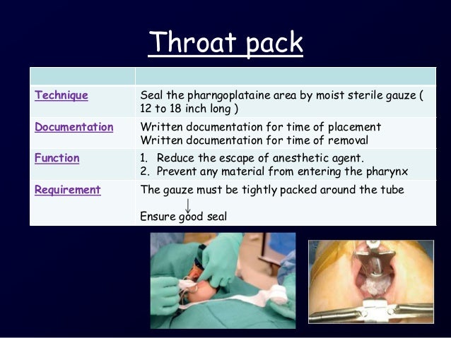 Hospital Dental Services for Children and the Use of General Anesthes…