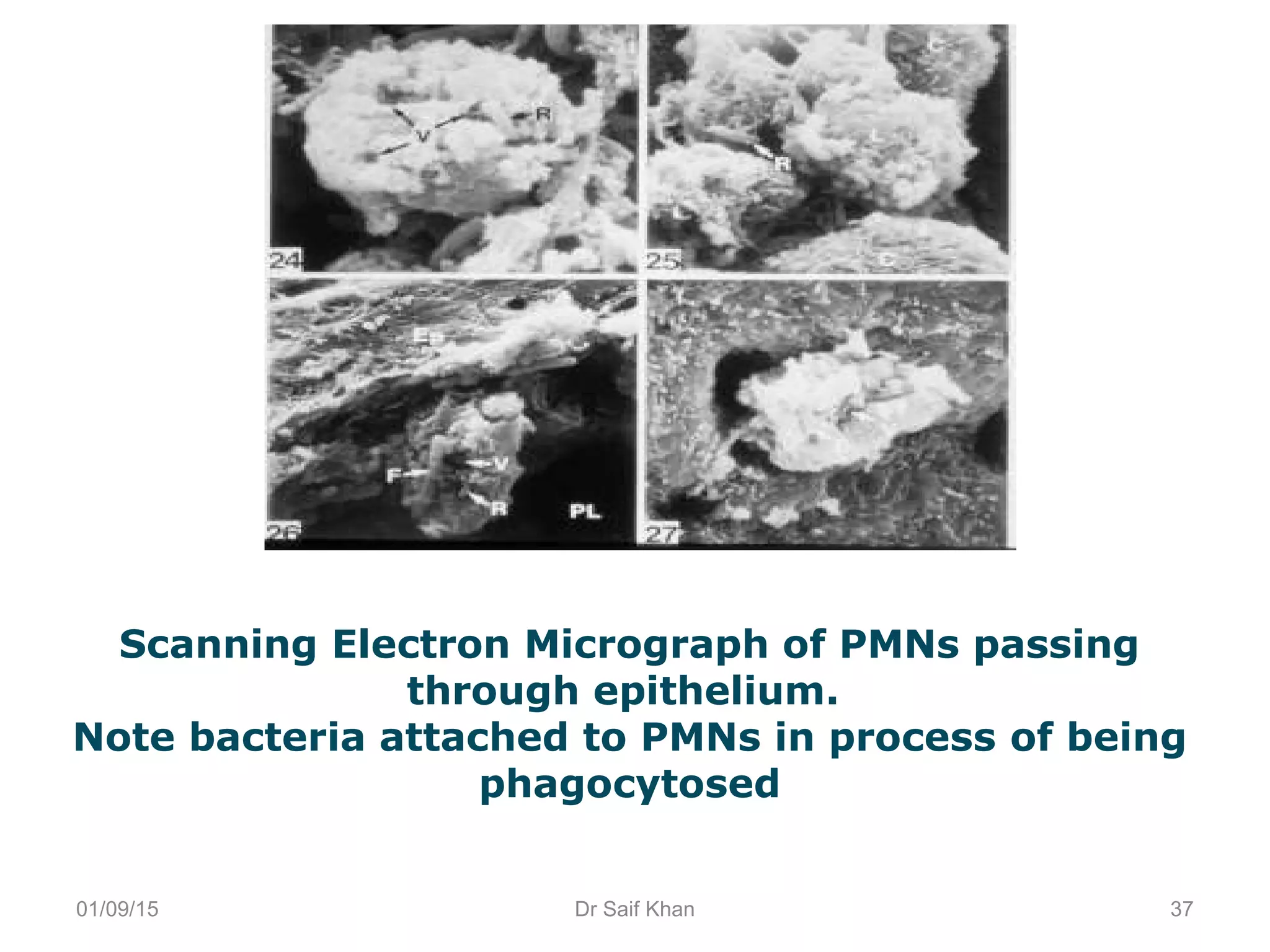 Host microbe interaction in periodontal disease | PPT