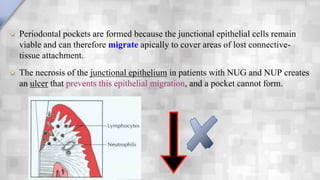 Host response to Necrotizing Ulcerative Disease (NUP+NUG) | PPT