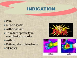 Hot application Procedure | PPTX