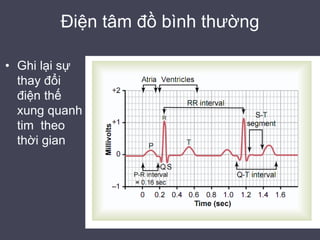 Khám nguyên nhân hình thành sơ đồ điện tim và mối quan hệ với tim mạch