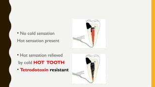 HOT TOOTH-1powepoinr presentation hs.pptx