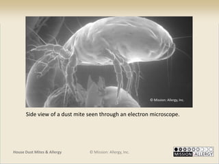Dust Mite Electron Microscope