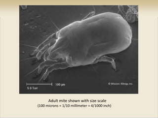 Dust Mites Size
