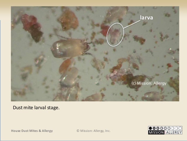 House Dust Mites & Allergy. Jeffrey D. Miller, MD