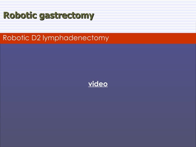 Robotic Gastrectomy for Gastric Cancer: a European Experience | PPT