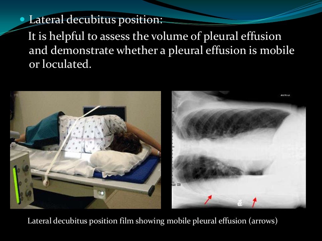 How to read normal x ray