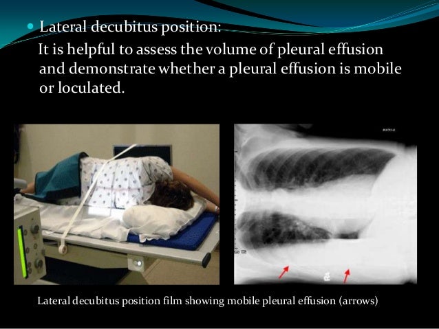 How to read normal x ray
