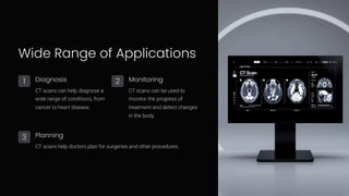 A look at How a CT Scan Works - Eric Hagerbrant | PDF
