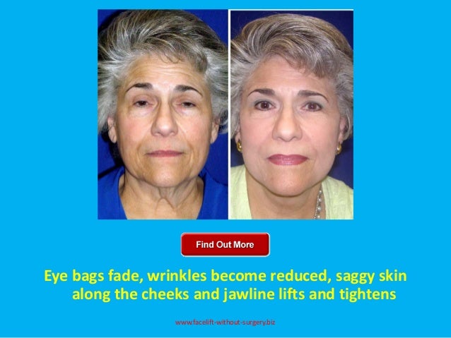 Do Holistic Face Aerobics Regimens Tone Flaccid Face Skin And Remedy