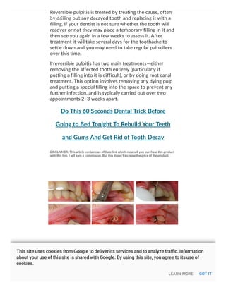 How to Get Rid of Toothache! | PDF