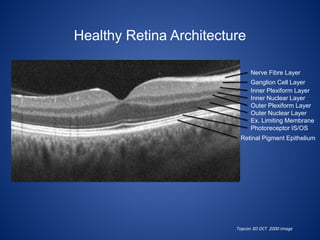 How-to-read-an-OCT-Image.pdf