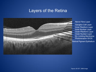 How-to-read-an-OCT-Image.pdf