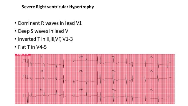 how-to-read-ECG-Final (1).pptx