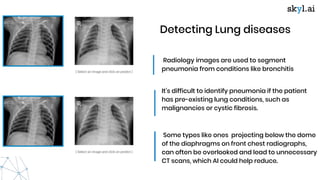 AI in Health Care: How to Implement Medical Imaging using Machine ...