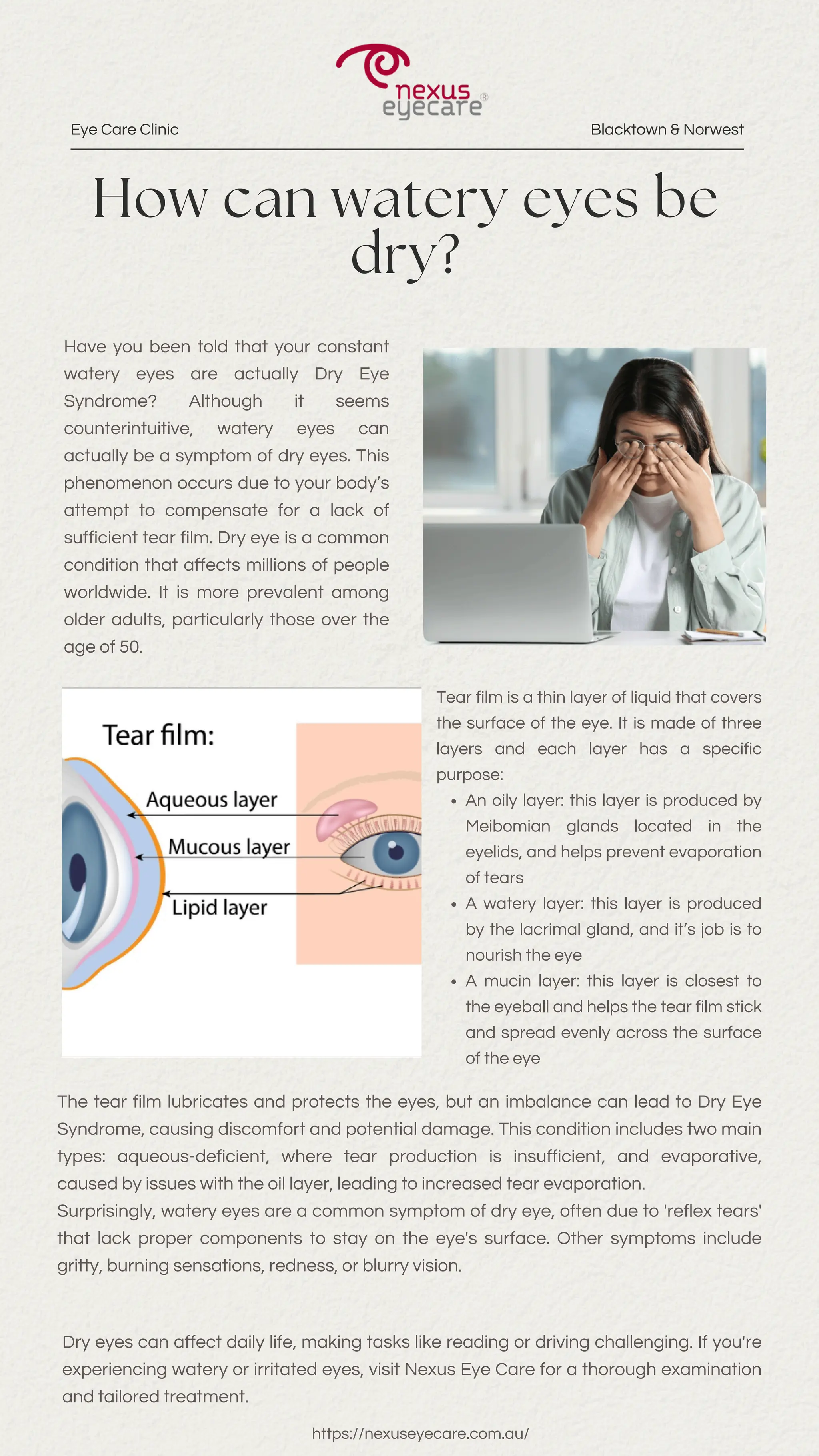 How can watery eyes be dry ? - Nexus Eye Care | PDF