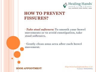 How Can You Deal With Anal Fissures | PPT
