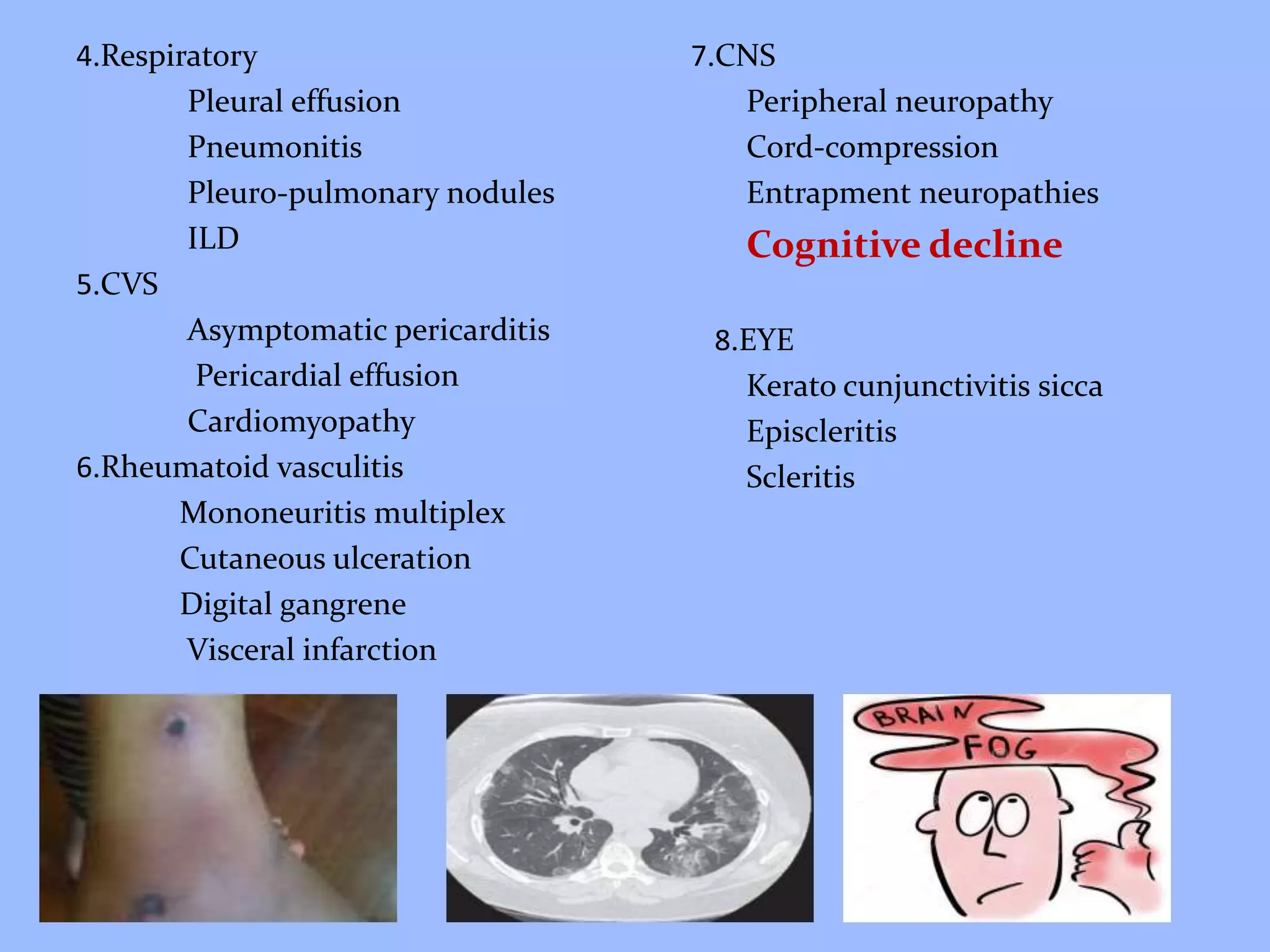 How chronic inflammation in rheumatoid arthritis affects brain pre | PPT