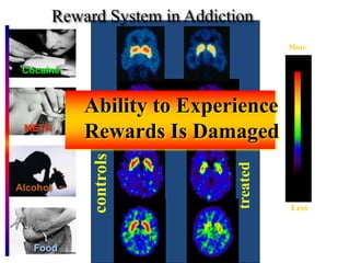 How does addiction occur. | PPT