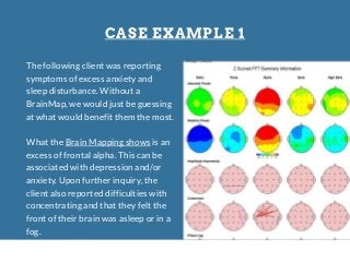 How Does Brain Mapping Help Your Treatment | PPTX