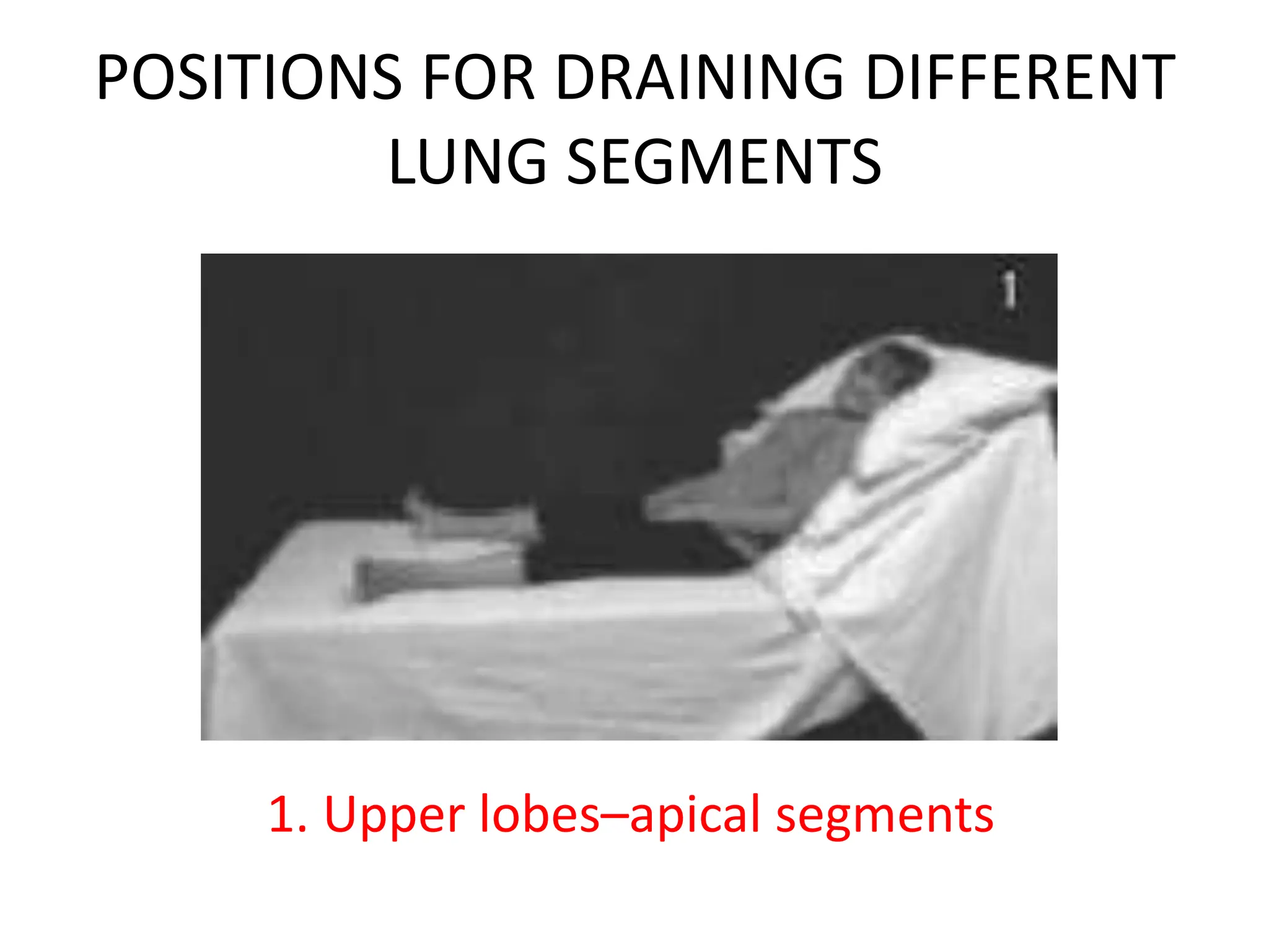 HOW DOES CF AFFECT LUNGS.pptx Physiotherapy management for cystic ...