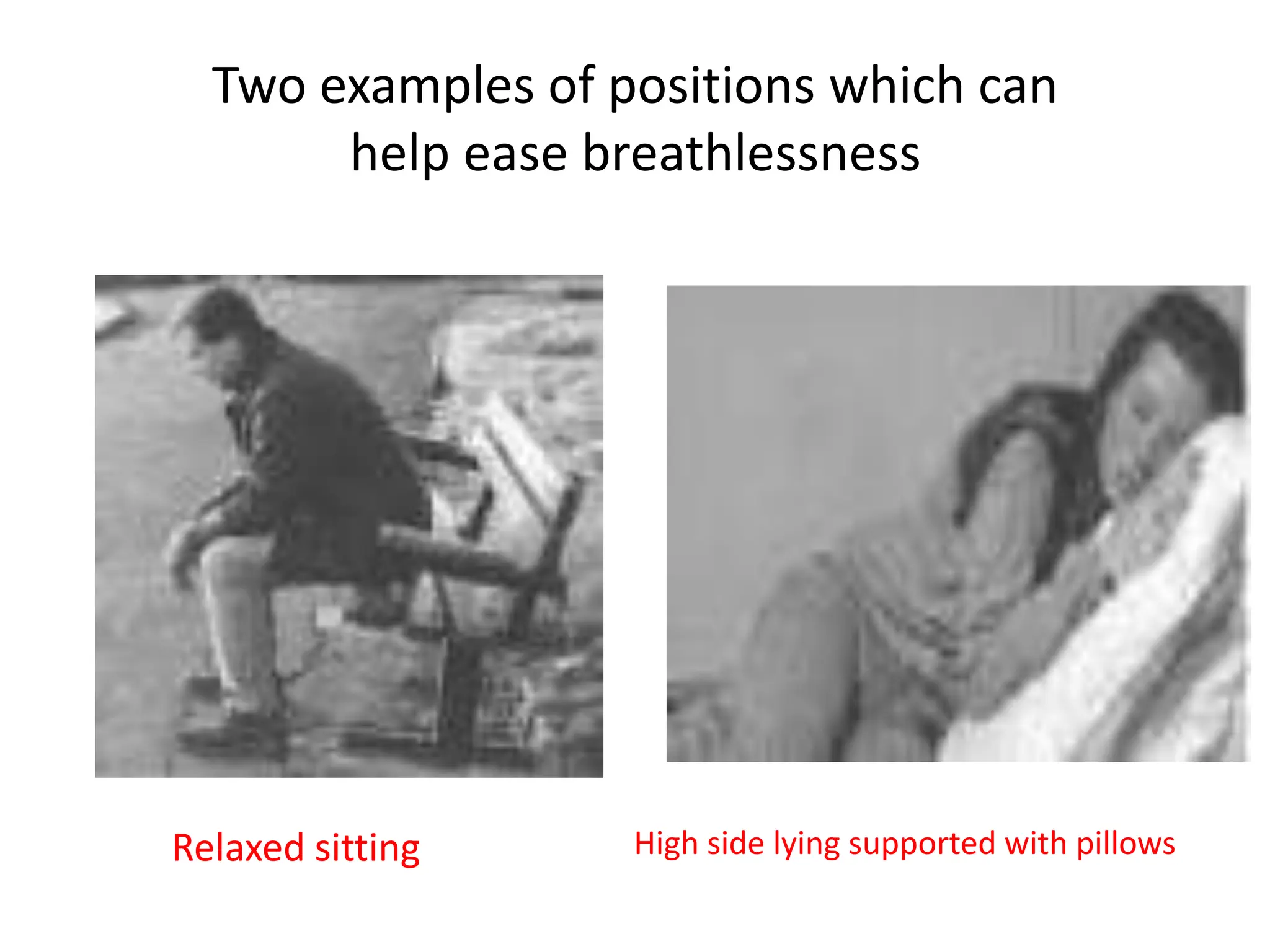 HOW DOES CF AFFECT LUNGS.pptx Physiotherapy management for cystic ...