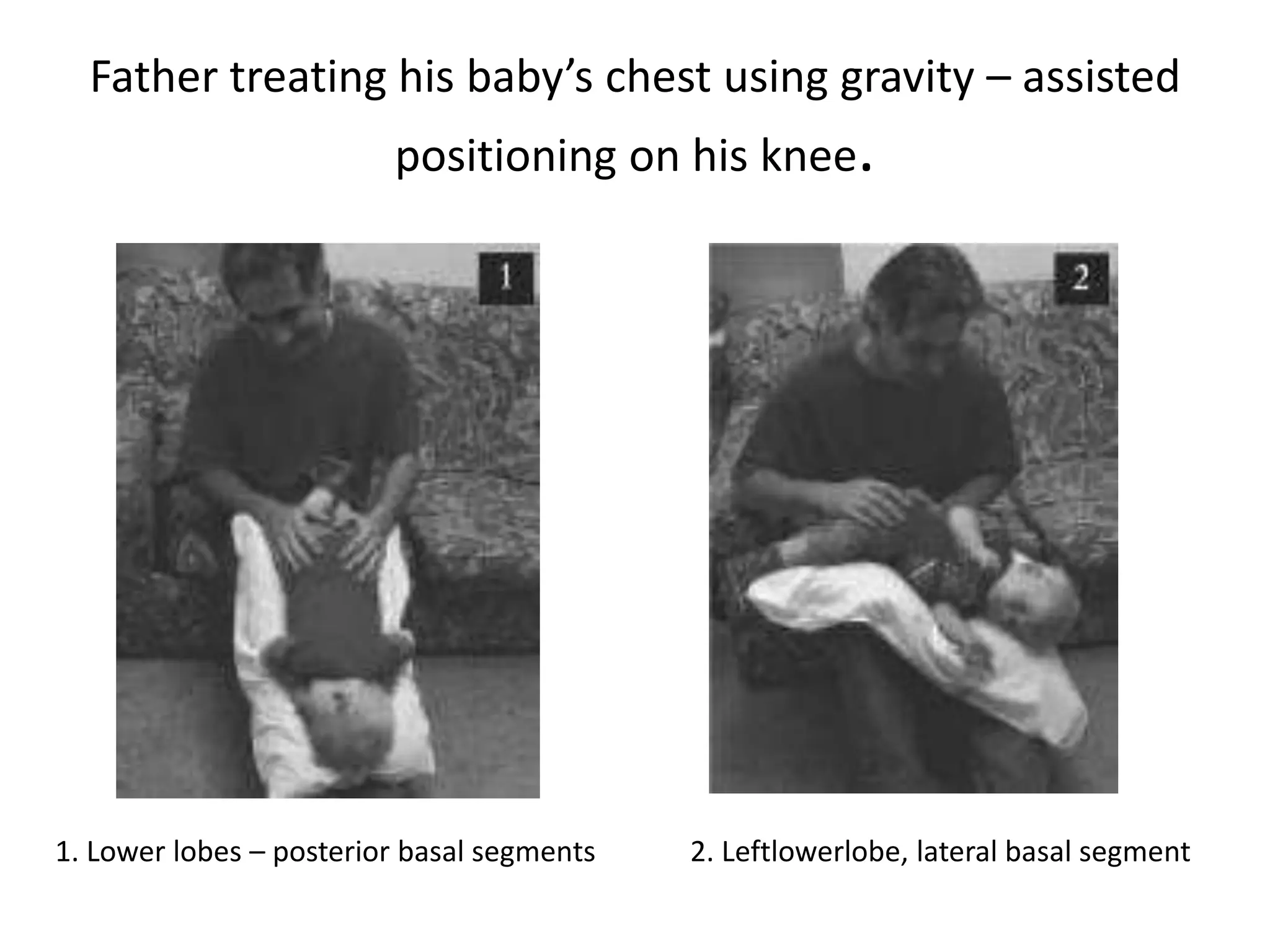 HOW DOES CF AFFECT LUNGS.pptx Physiotherapy management for cystic ...