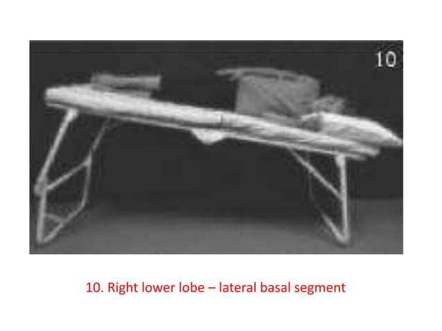 HOW DOES CF AFFECT LUNGS.pptx Physiotherapy management for cystic ...