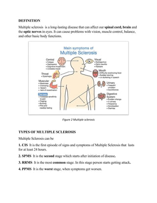 How does multiple sclerosis afffect brain | PDF