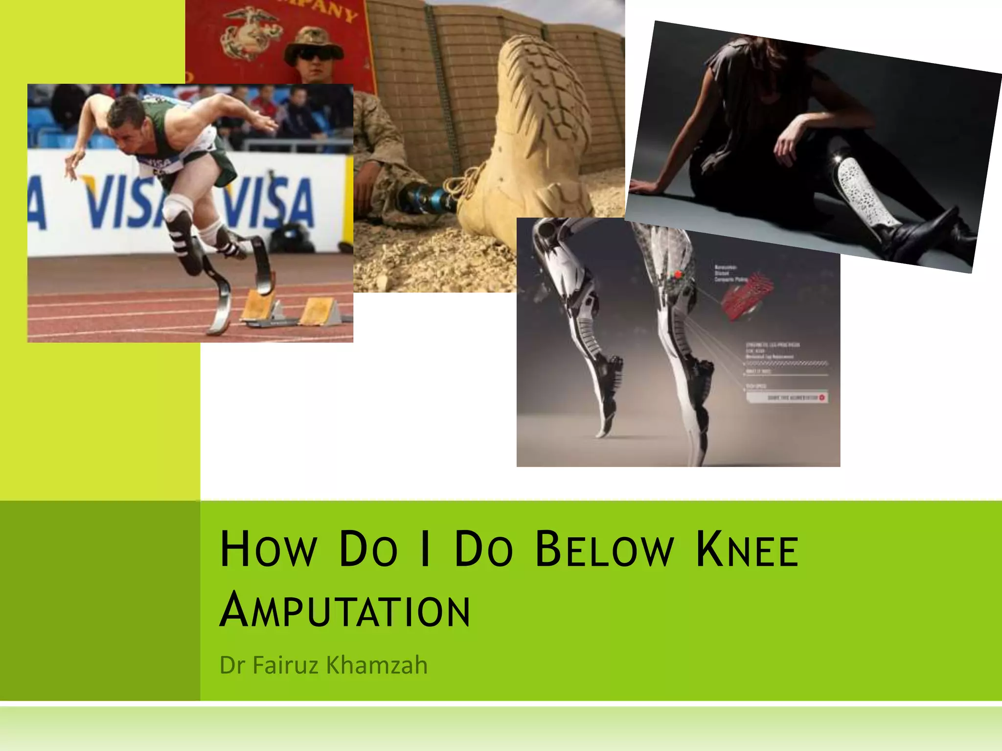 How Do I Do Below Knee Amputation.pptx