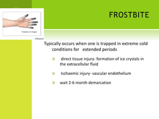 How Do I Do Below Knee Amputation.pptx