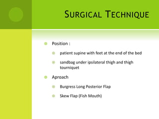 How Do I Do Below Knee Amputation.pptx