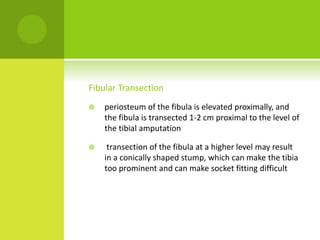 How Do I Do Below Knee Amputation.pptx