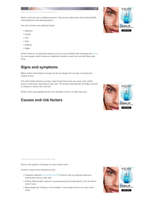 How do i get rid of stretch marks | PDF | Pregnancy | Reproductive Health