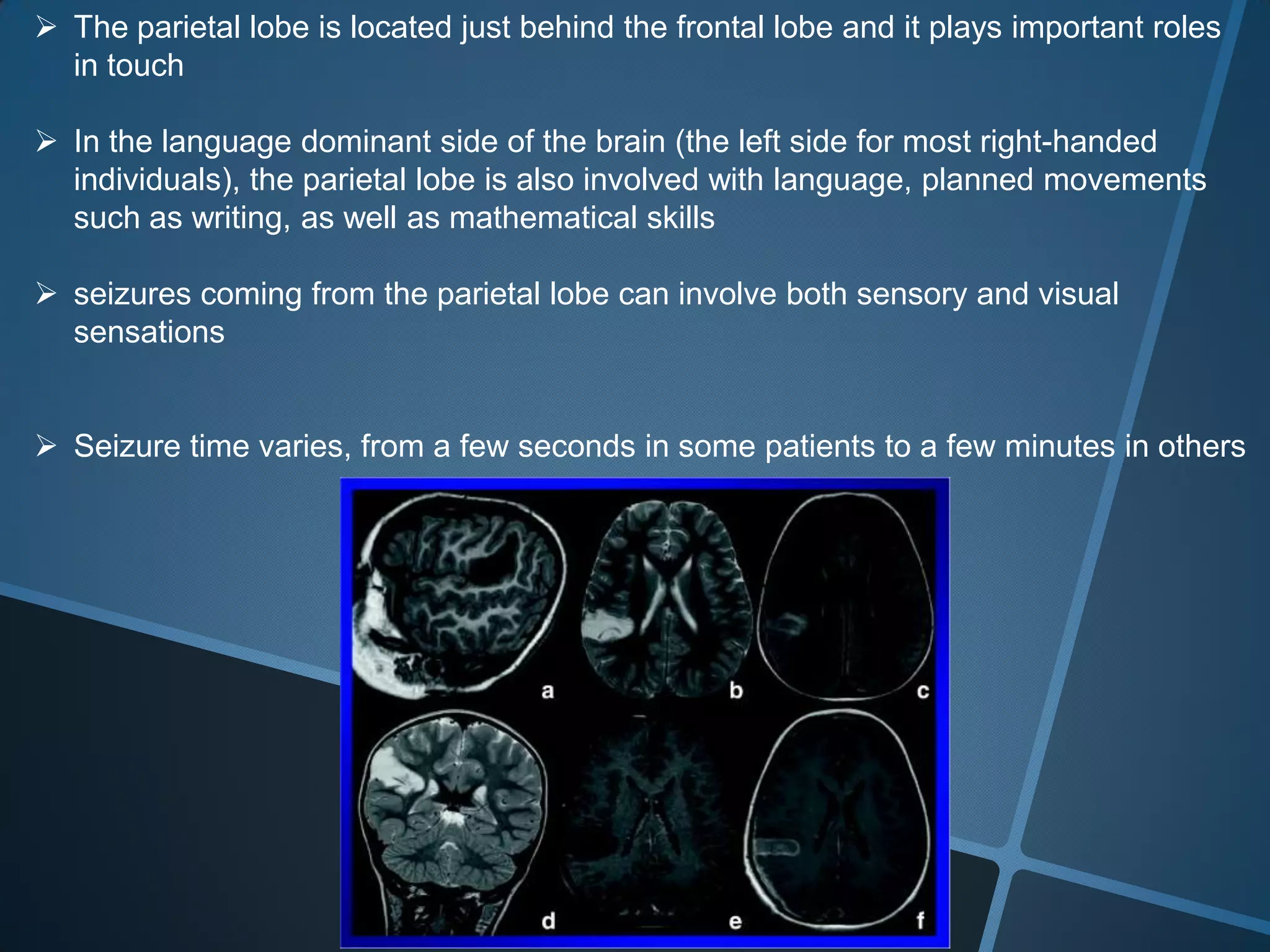 How epilepsy effects the brain in parietal lobe | PPTX