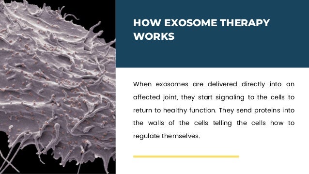 How Exosome Therapy Works And Its Benefits - Dr. David Greene R3 Stem ...