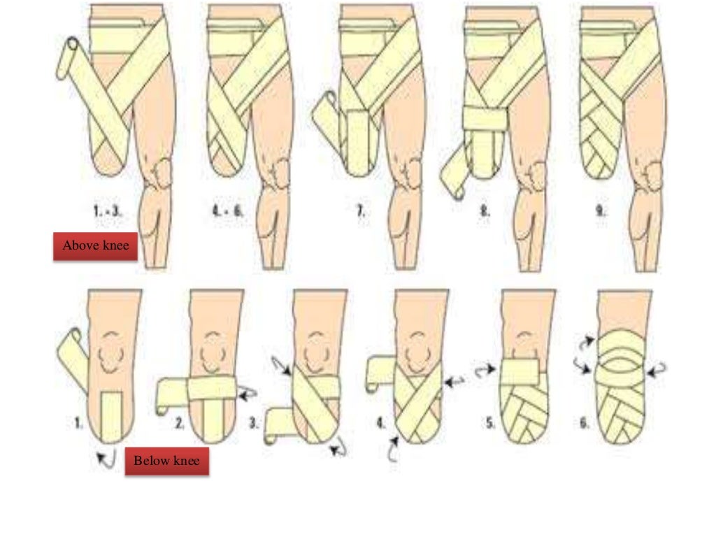 How i do below knee amputation