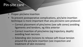 How I do Ilizarov Tibia.pptx