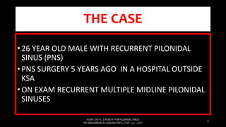 How I do it...Z-plasty for Pilonidal Sinus | PPTX