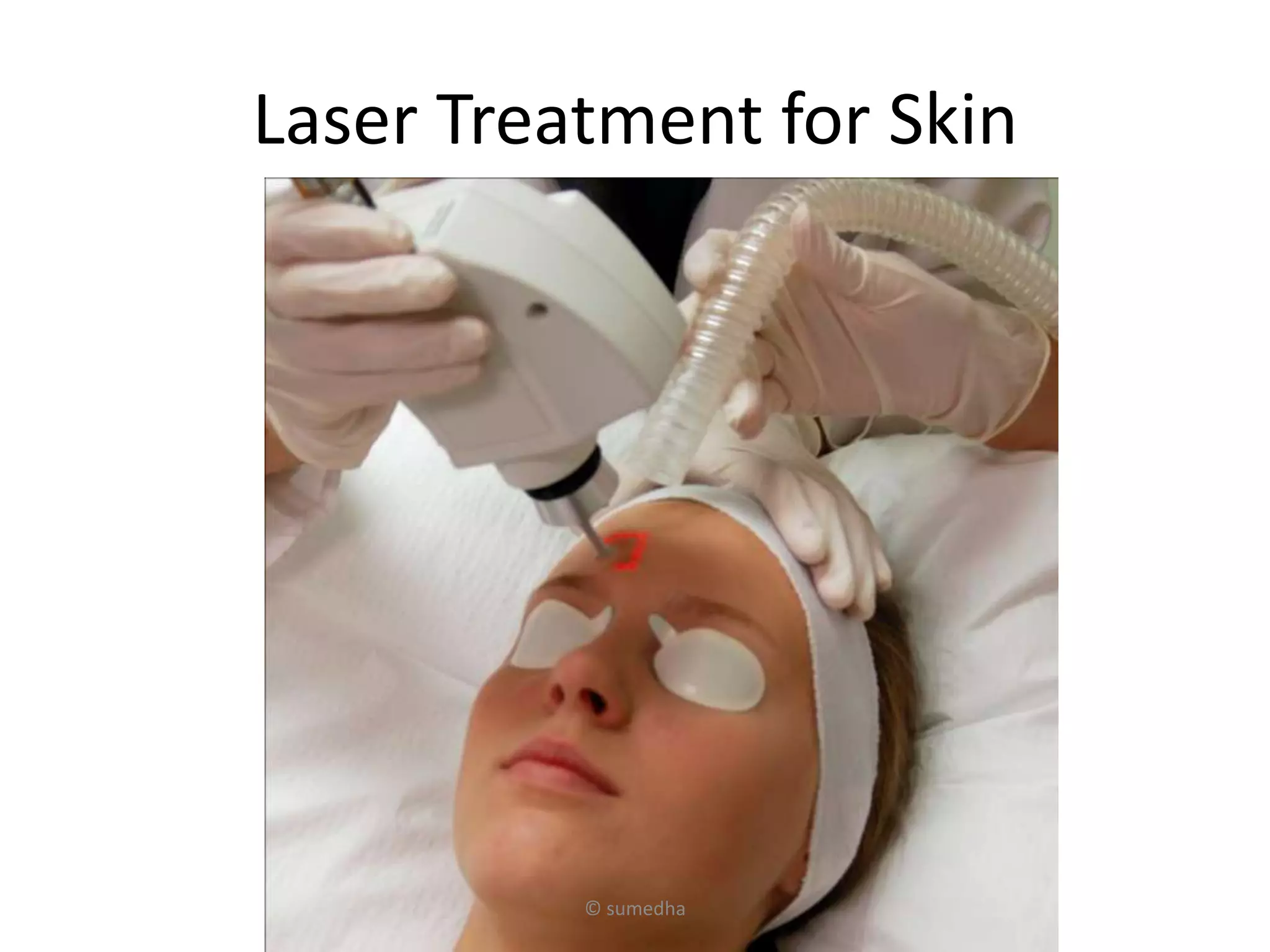 How laser work | PPSX