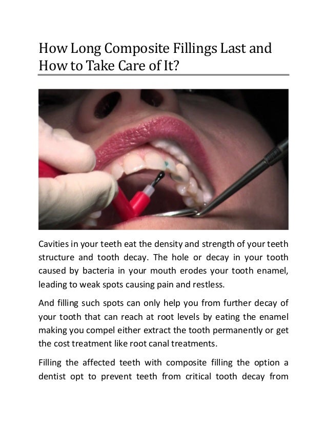 How Long Composite Fillings Last And Take Care Of It